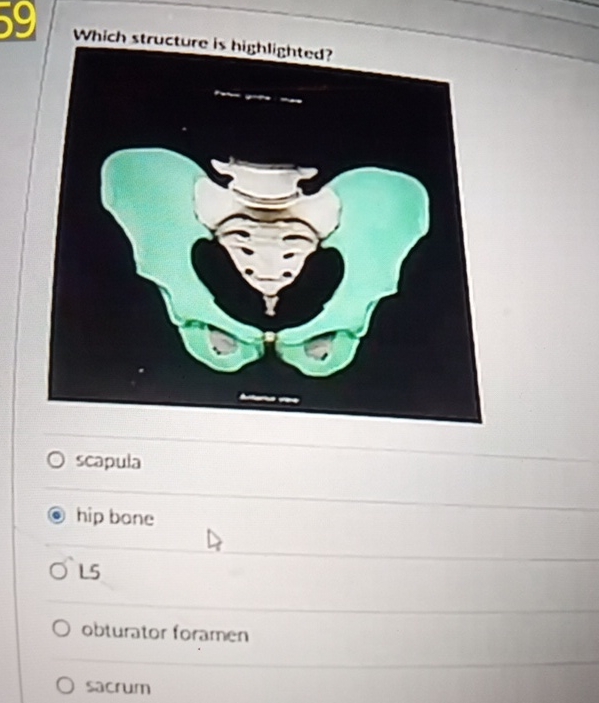 Solved Which structure is highlighted?scapulahip | Chegg.com