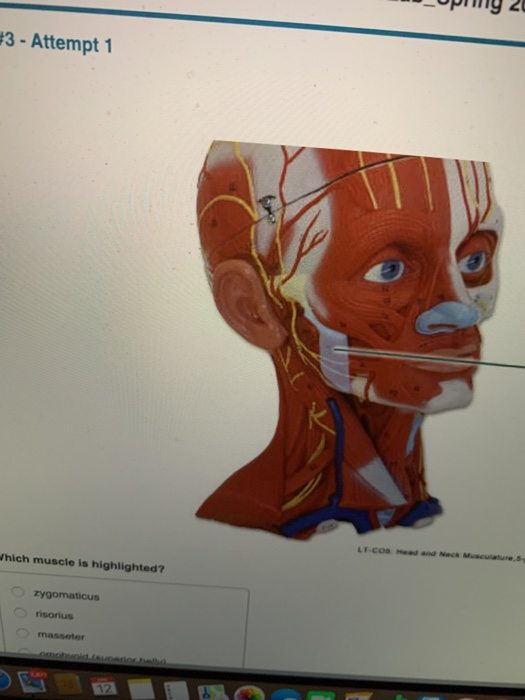 Solved _upimy 2 #3 - Attempt 1 LT-COS Which muscle is | Chegg.com