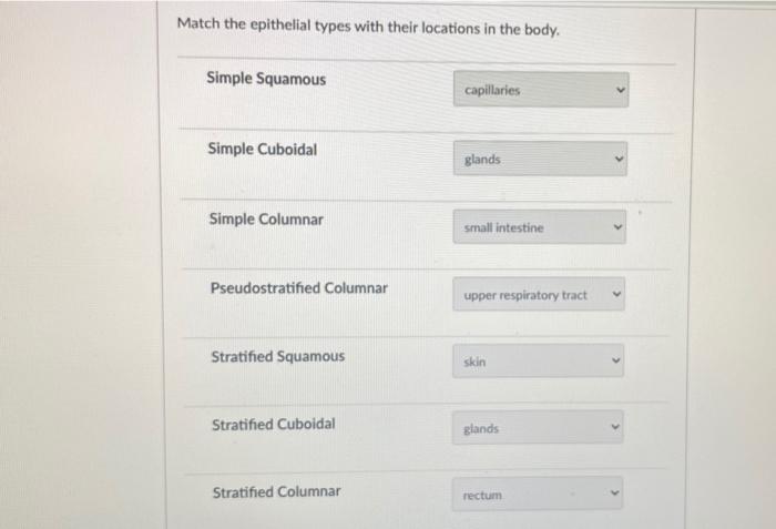 Solved Match the epithelial types with their locations in | Chegg.com