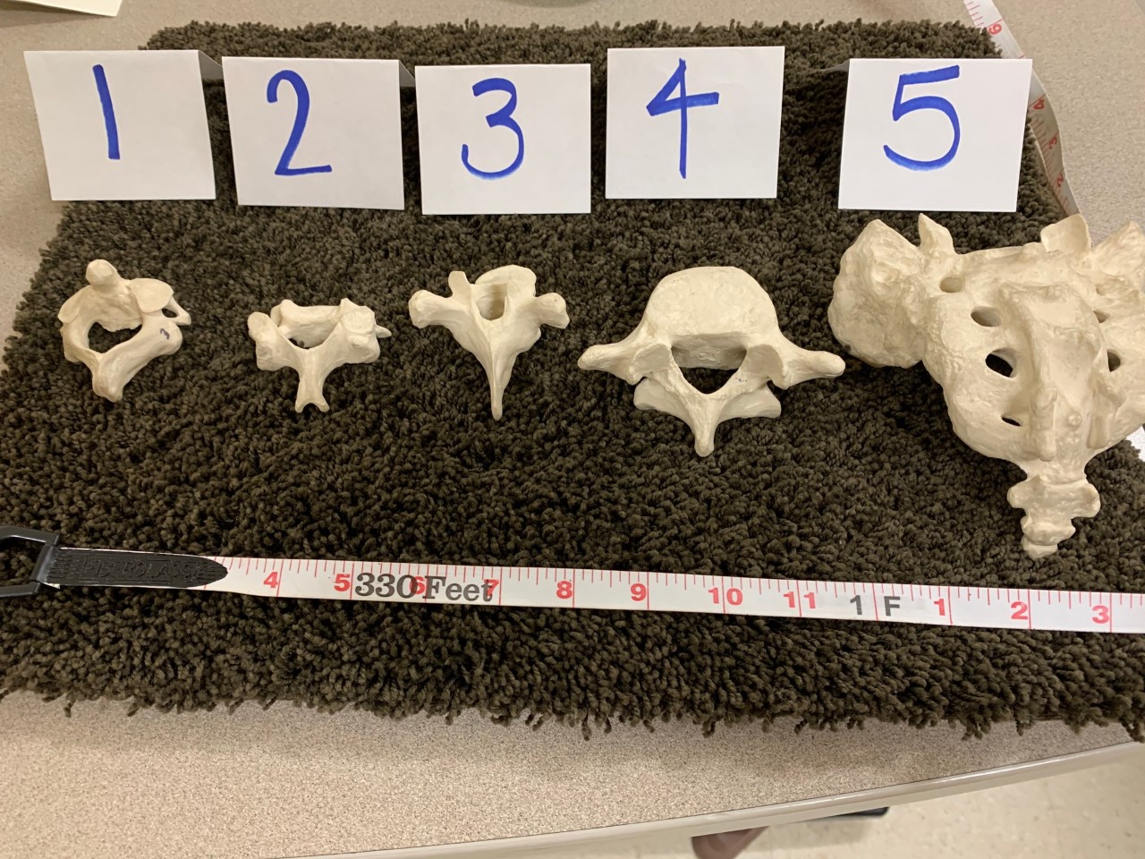 Solved Match the number associated with the bone in the | Chegg.com