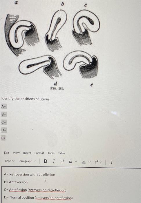Solved Identify the positions of uterus. | Chegg.com