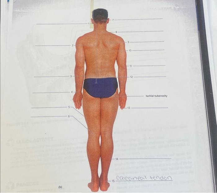 Solved label the parts | Chegg.com