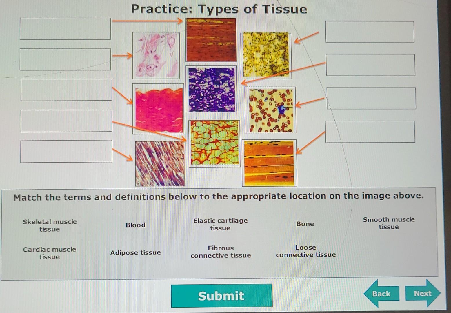 Solved Match the terms and definitions below to the | Chegg.com