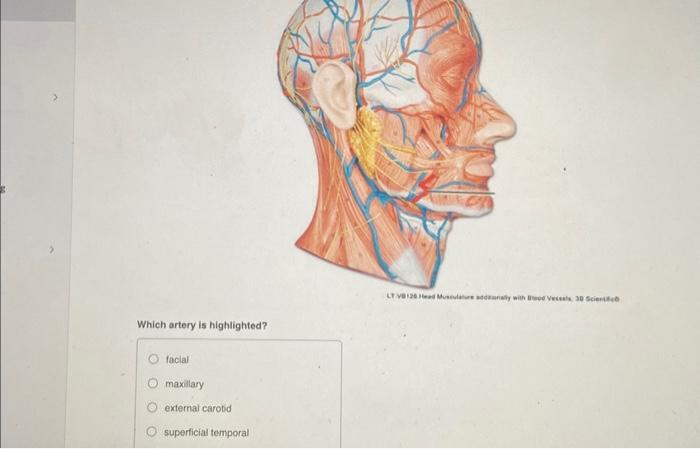 Solved Which artery is highlighted? facial maxilary external | Chegg.com