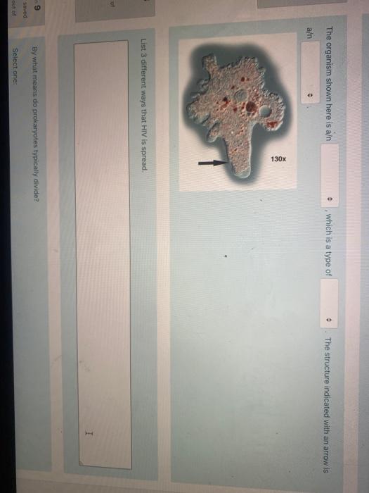 Solved uestion 1 Name the microbe shown here. nswer saved | Chegg.com Solved uestion 1 Name the microbe shown here. nswer saved | Chegg.com