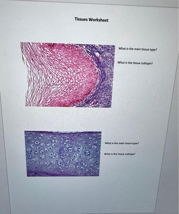 Solved −Tissues Worksheet What is the main tissue type What | Chegg.com