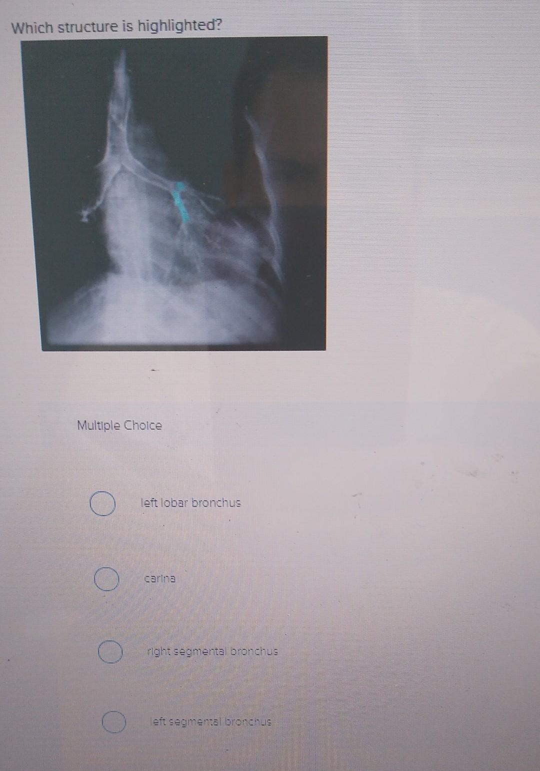 Solved Which structure is highlighted? Multiple Cholce | Chegg.com