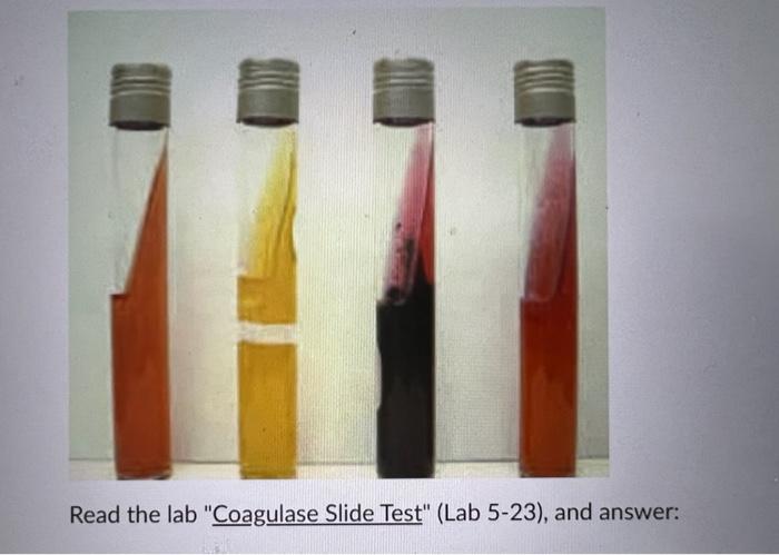 Solved Read the lab "Coagulase Slide Test" (Lab 5-23), and | Chegg.com