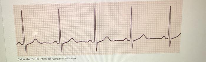 Solved Annah ap Calculate the PR interval? (Using the EKG | Chegg.com