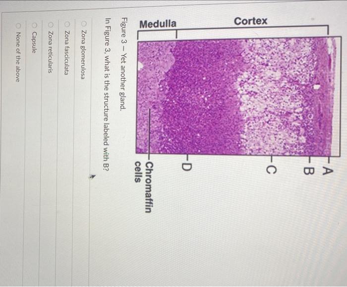 Solved Cortex Medulla Zona glomerulosa Zona fasciculata Zona | Chegg.com