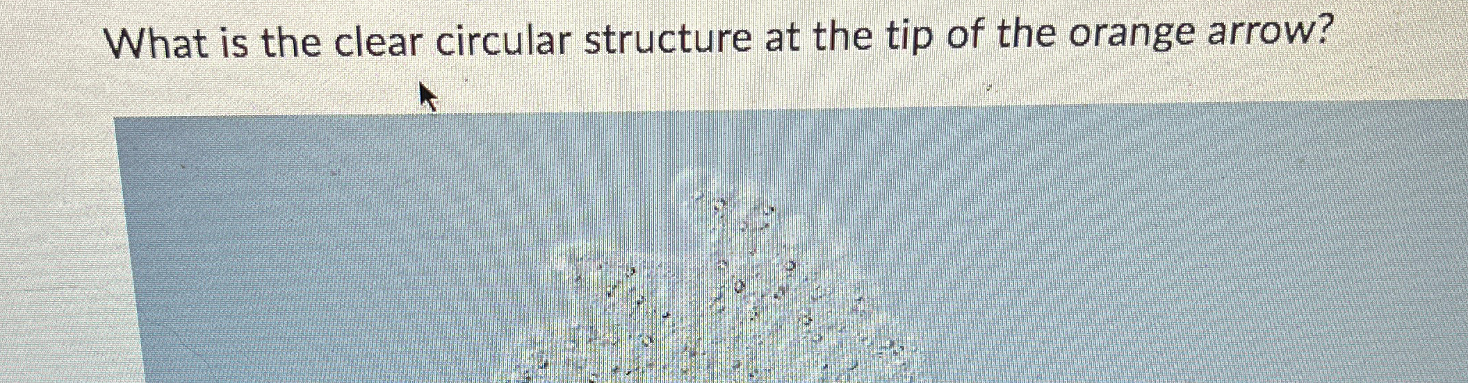 Solved What is the clear circular structure at the tip of | Chegg.com