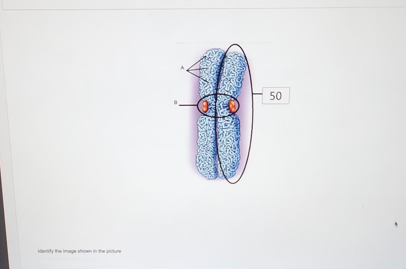 Solved Identify the image shown in the picture | Chegg.com