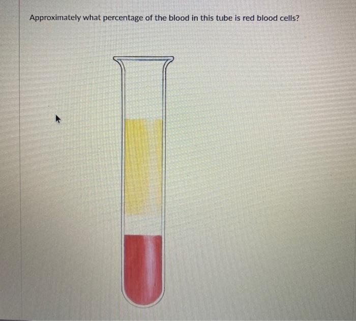 Solved In the graph of pacemaker cell action potential | Chegg.com