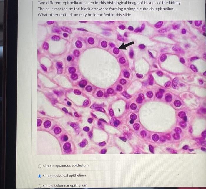 Simple Cuboidal Epithelium Kidney