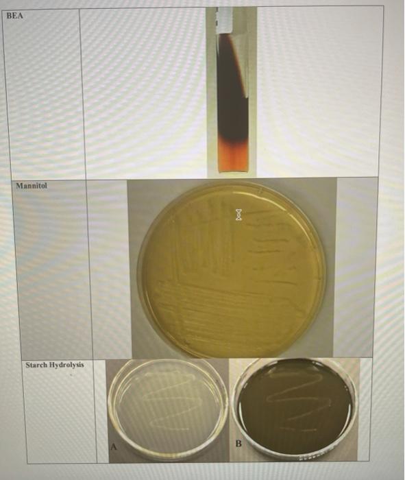 Solved Part 2: Media and Biochemical Tests For Gram Positive | Chegg.com