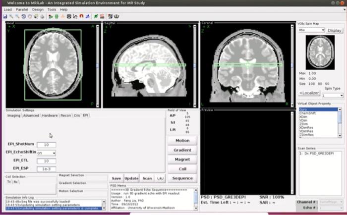 Solved in ECHO PLANER IMAGING (EPI) experiment in MRI , | Chegg.com