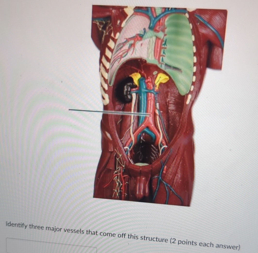 Solved Identify three major vessels that come off this | Chegg.com