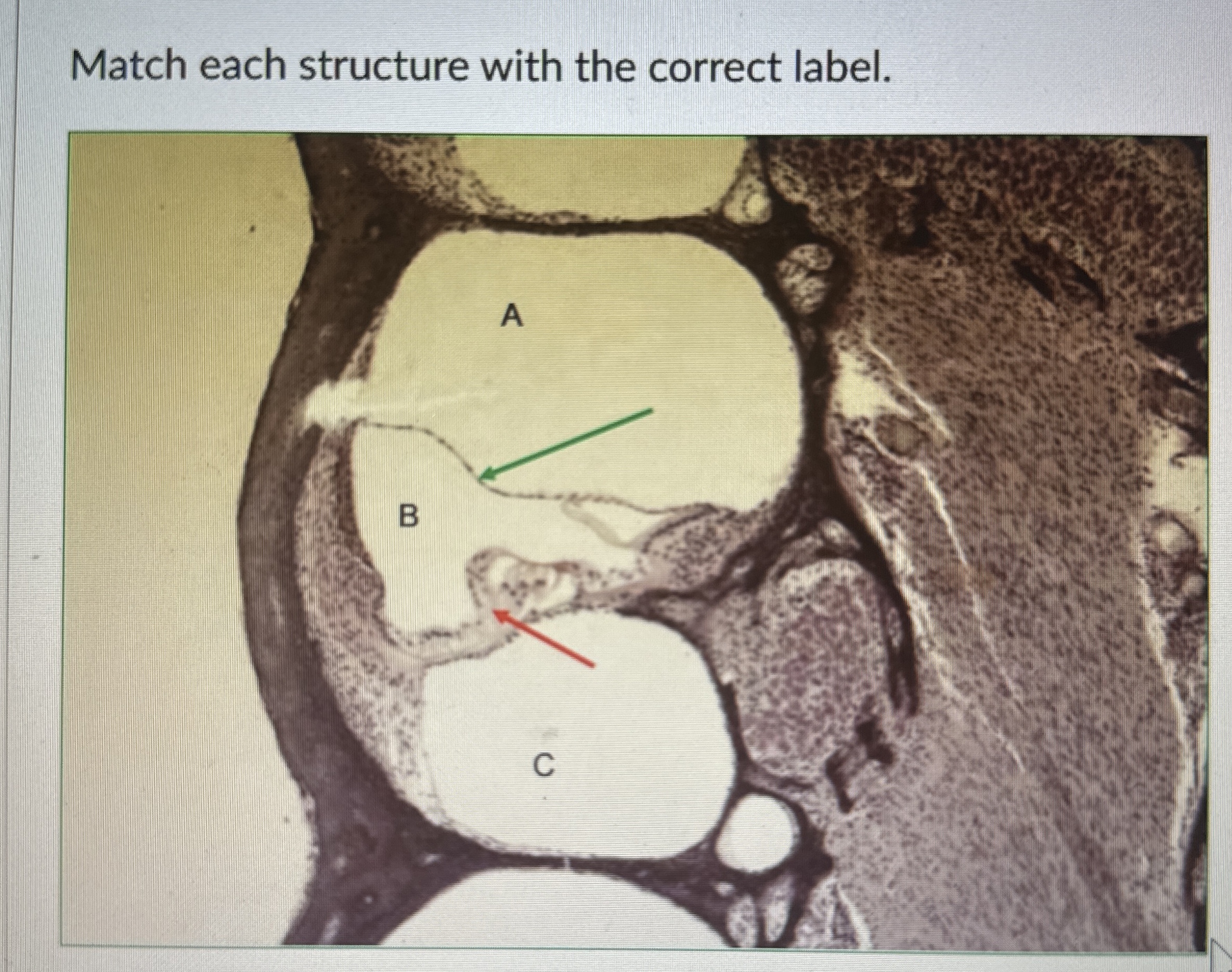 Solved Match each structure with the correct label. | Chegg.com