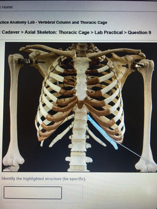 Solved Home ctice Anatomy Lab - Vertebral Column and | Chegg.com