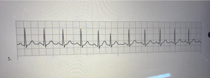 Solved identify the QRS, QT, heart rate and PR, ST, and | Chegg.com