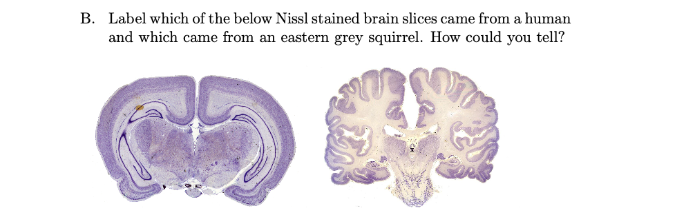 Solved B. ﻿Label which of the below Nissl stained brain | Chegg.com