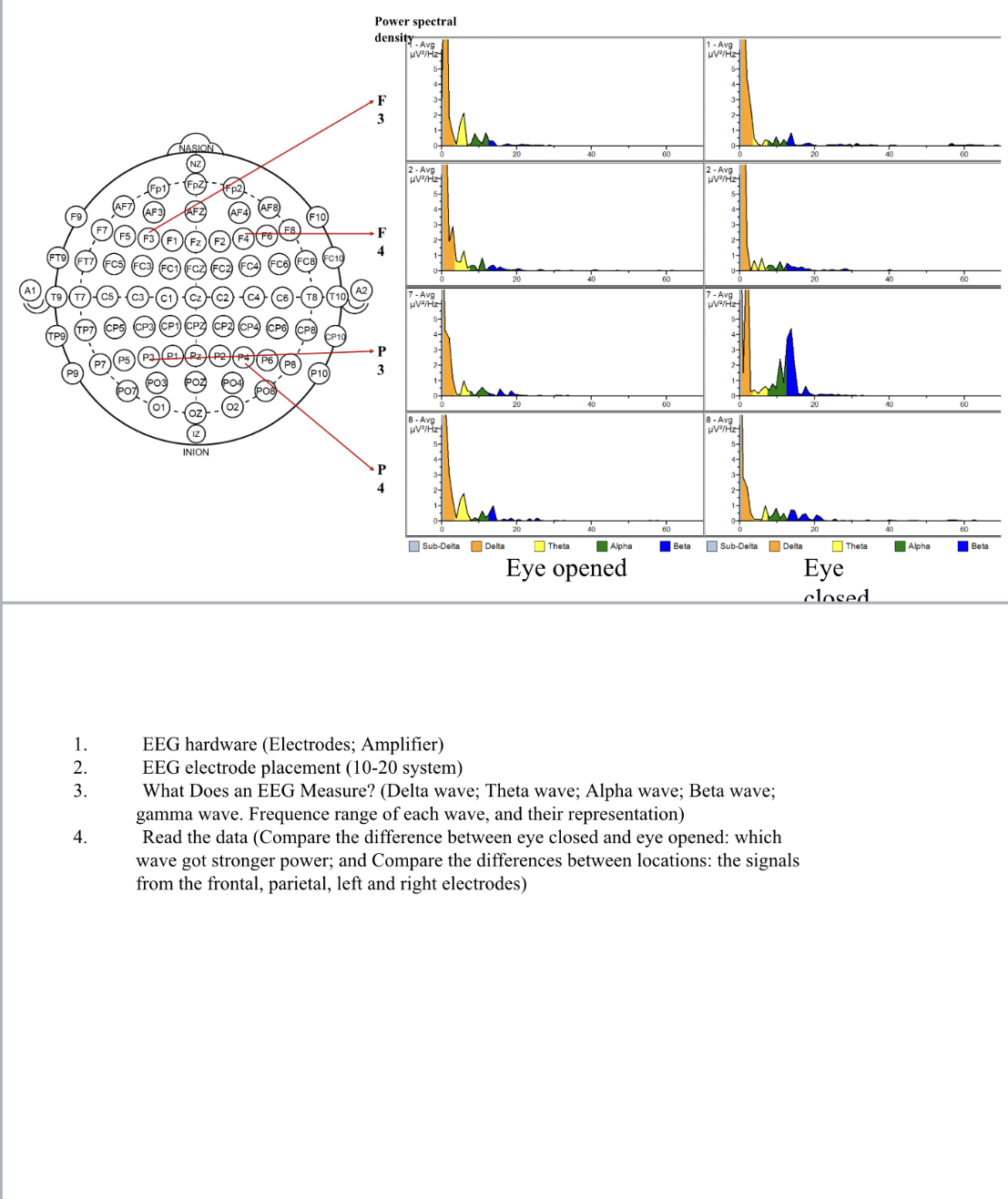 Solved EEG hardware (Electrodes; Amplifier)EEG electrode | Chegg.com