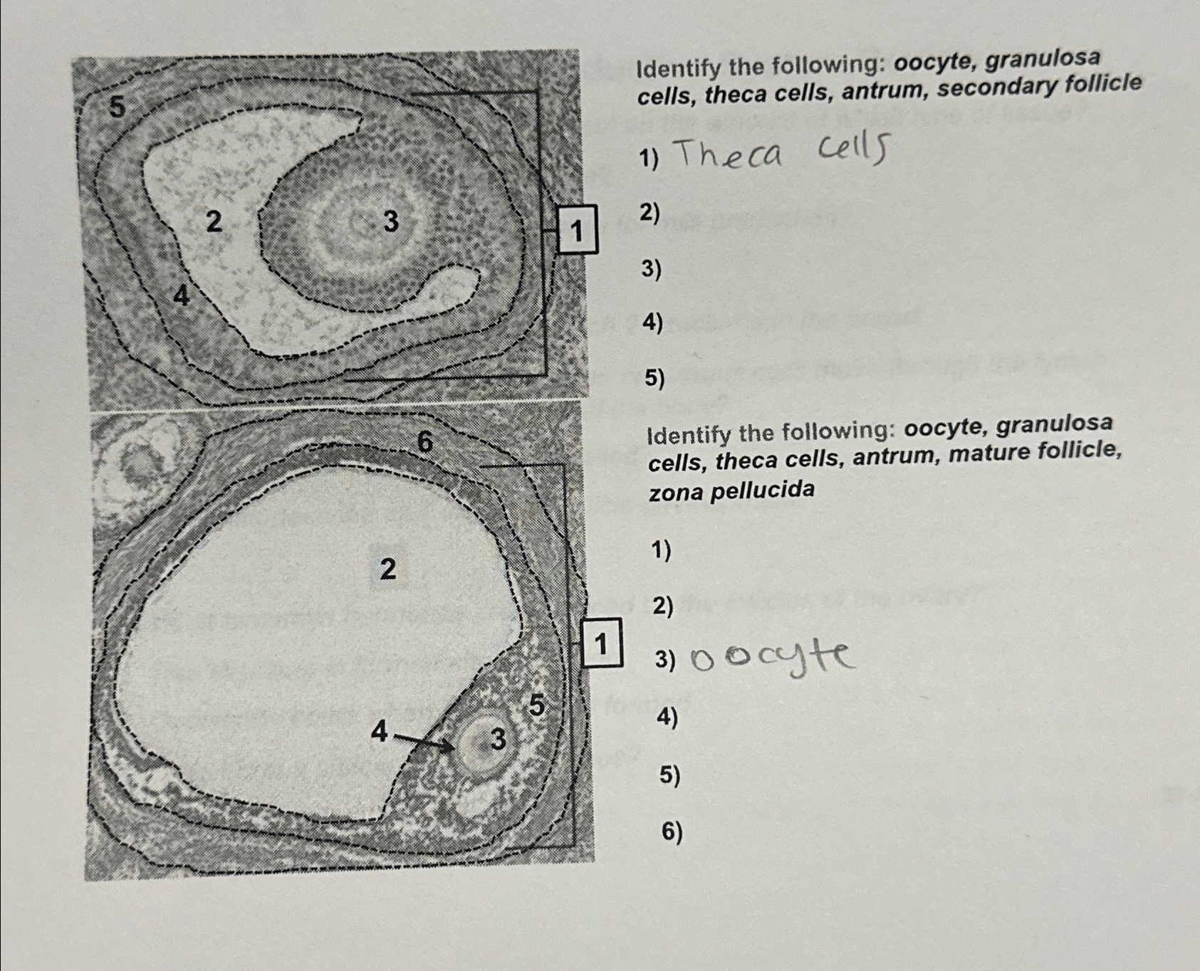 Solved Identify the following: oocyte, granulosa cells, | Chegg.com