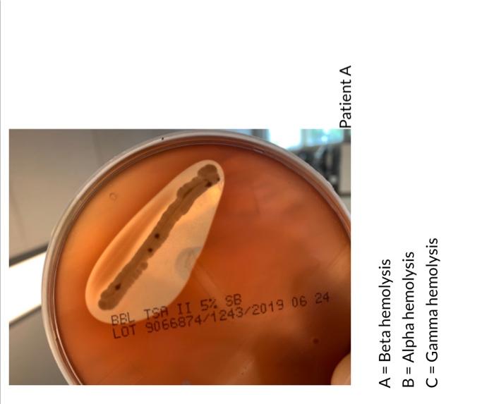 EXERCISE 14: BLOOD AGAR PLATE(BAP) Complete the table | Chegg.com