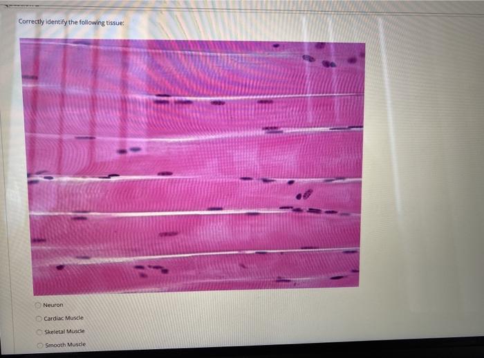 Dense Regular Connective Tissue Vs Smooth Muscle