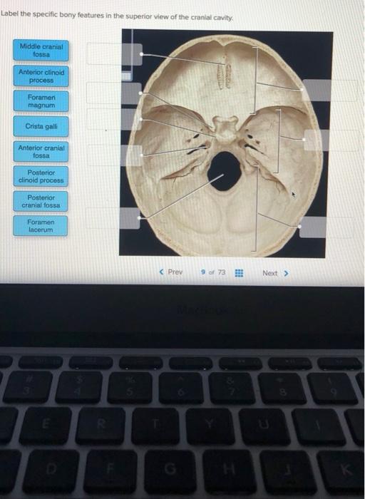 Solved Tes 9 He Label The Specific Bony Features In Chegg