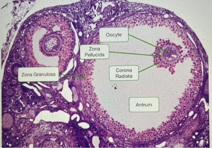 Solved Oocyte Zona Pellucida Zona Granulosa Corona Radiata | Chegg.com
