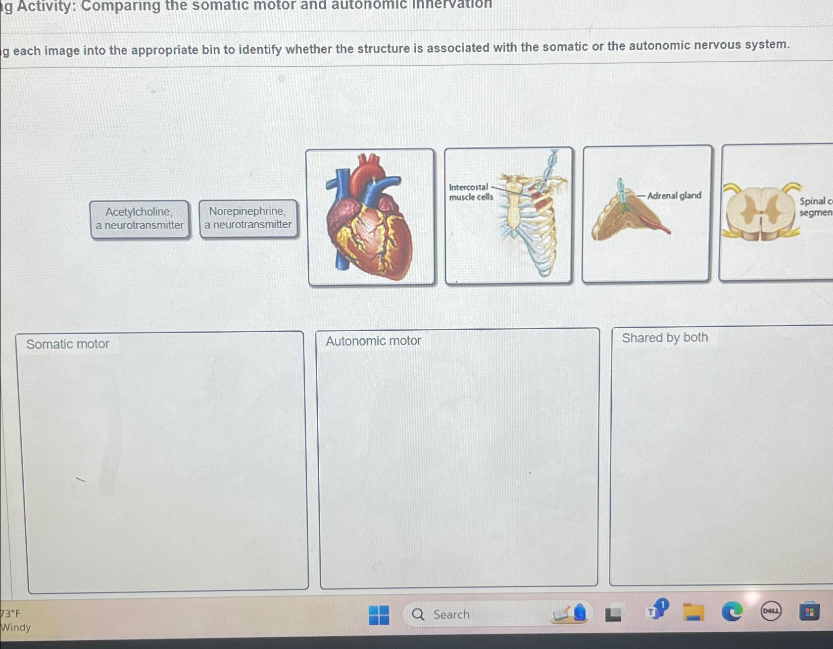 Solved Ig Activity: Comparing the somatic motor and | Chegg.com