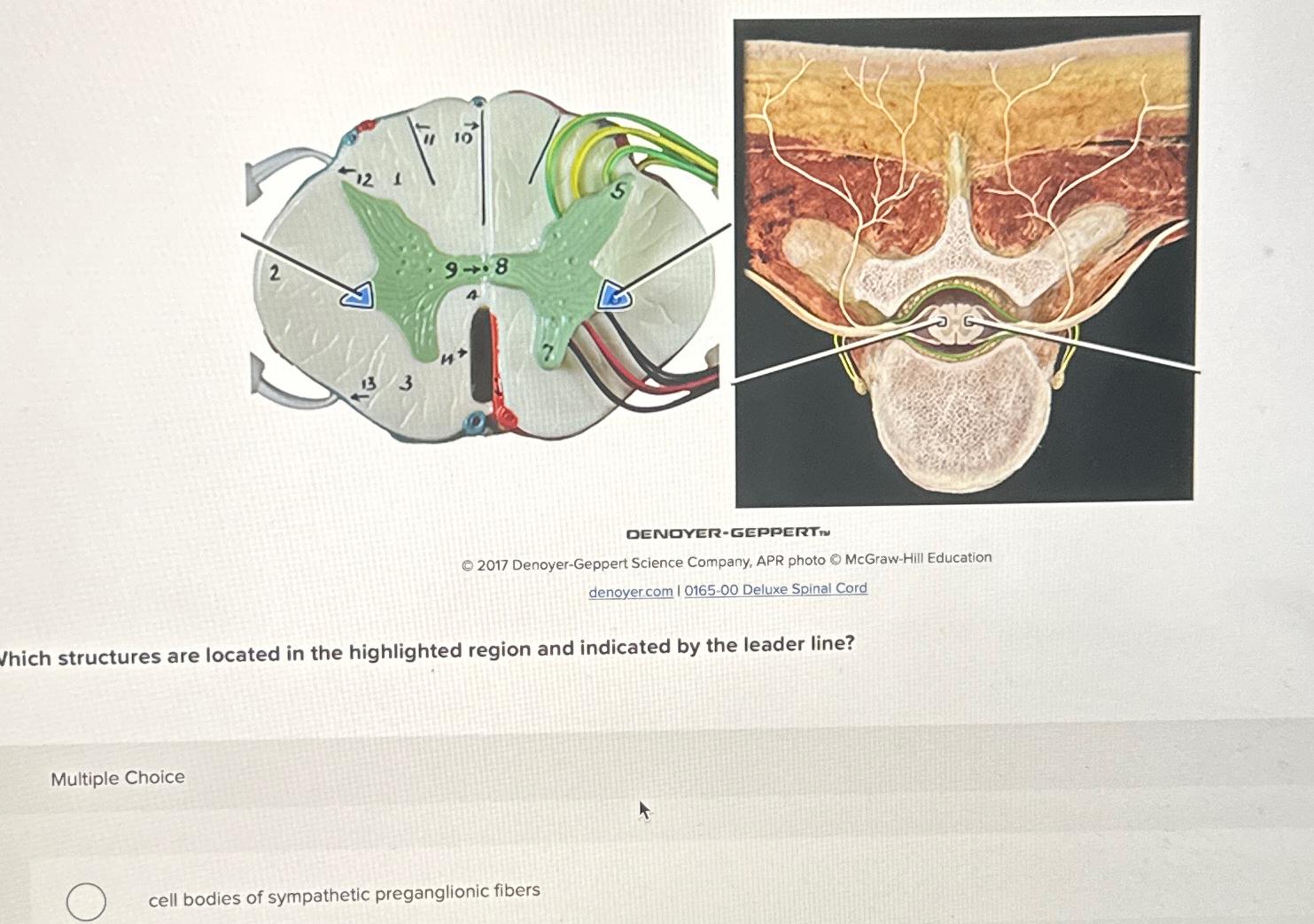 Solved DENOYER-GEPPERTT(C) 2017 ﻿Denoyer-Geppert Science | Chegg.com