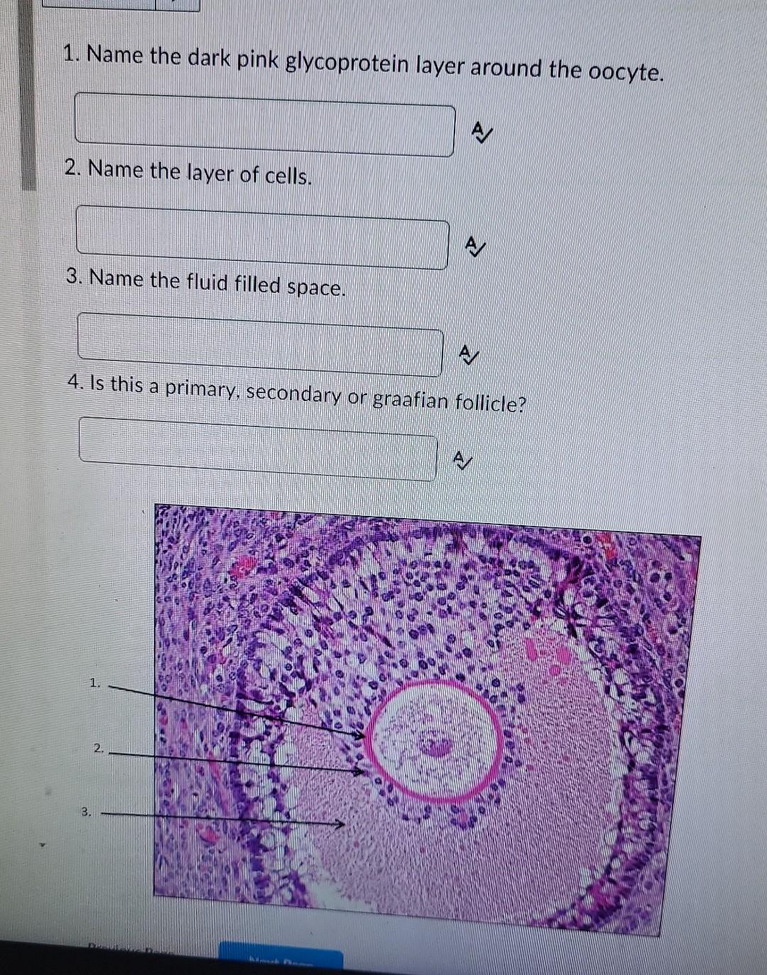 Solved Embryonic Development 1. Name the hollow structure of | Chegg.com