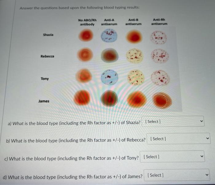 Solved Answer the questions based upon the following blood | Chegg.com