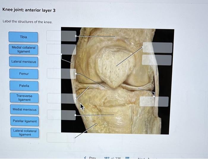 Solved Knee joint: anterior layer 3 Label the structures of | Chegg.com