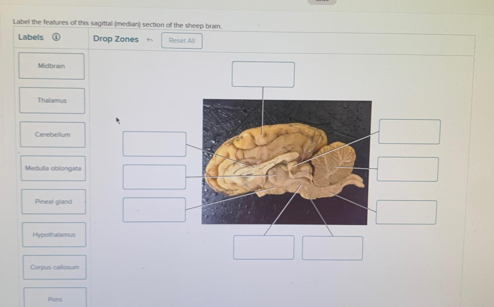 Solved Label the features of this sagittal (median) ﻿section | Chegg.com