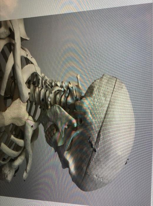 Solved label the following bones | Chegg.com