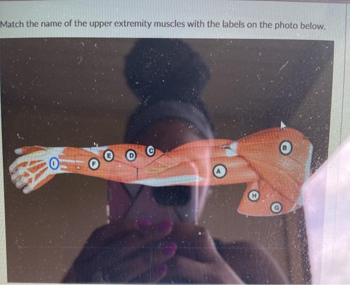 Solved Match the name of the upper extremity with the lables | Chegg.com