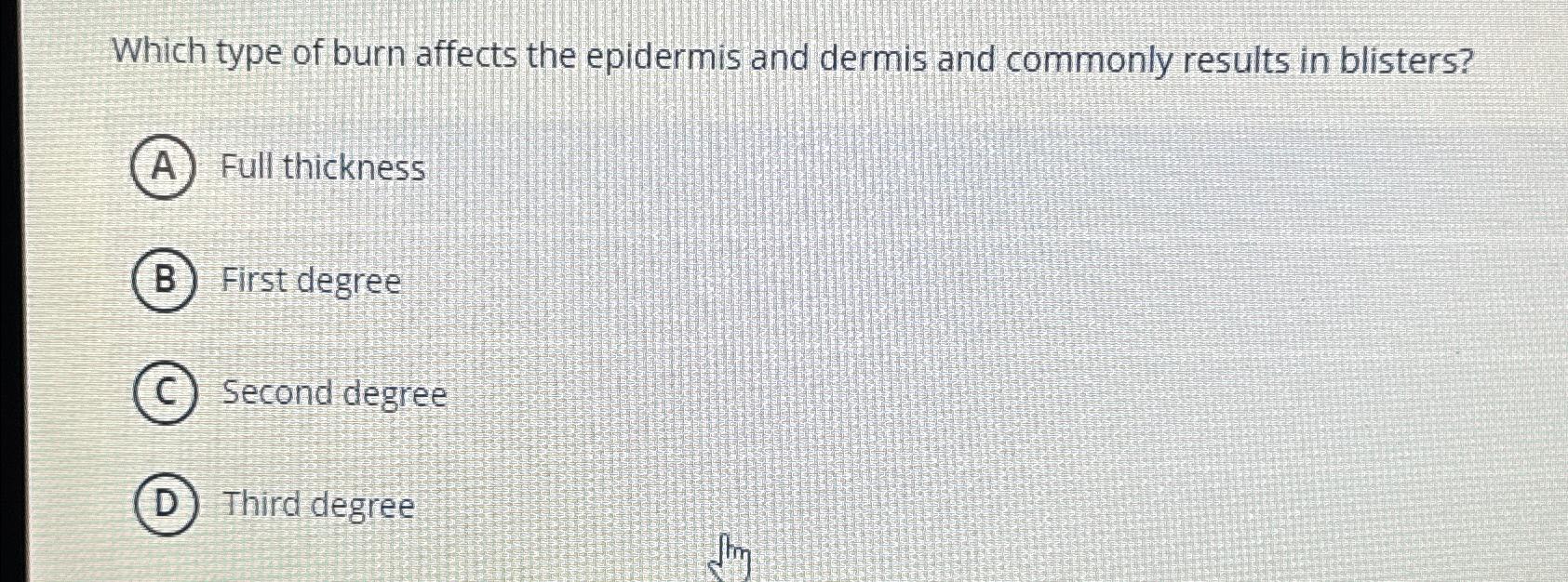 Solved Which type of burn affects the epidermis and dermis | Chegg.com