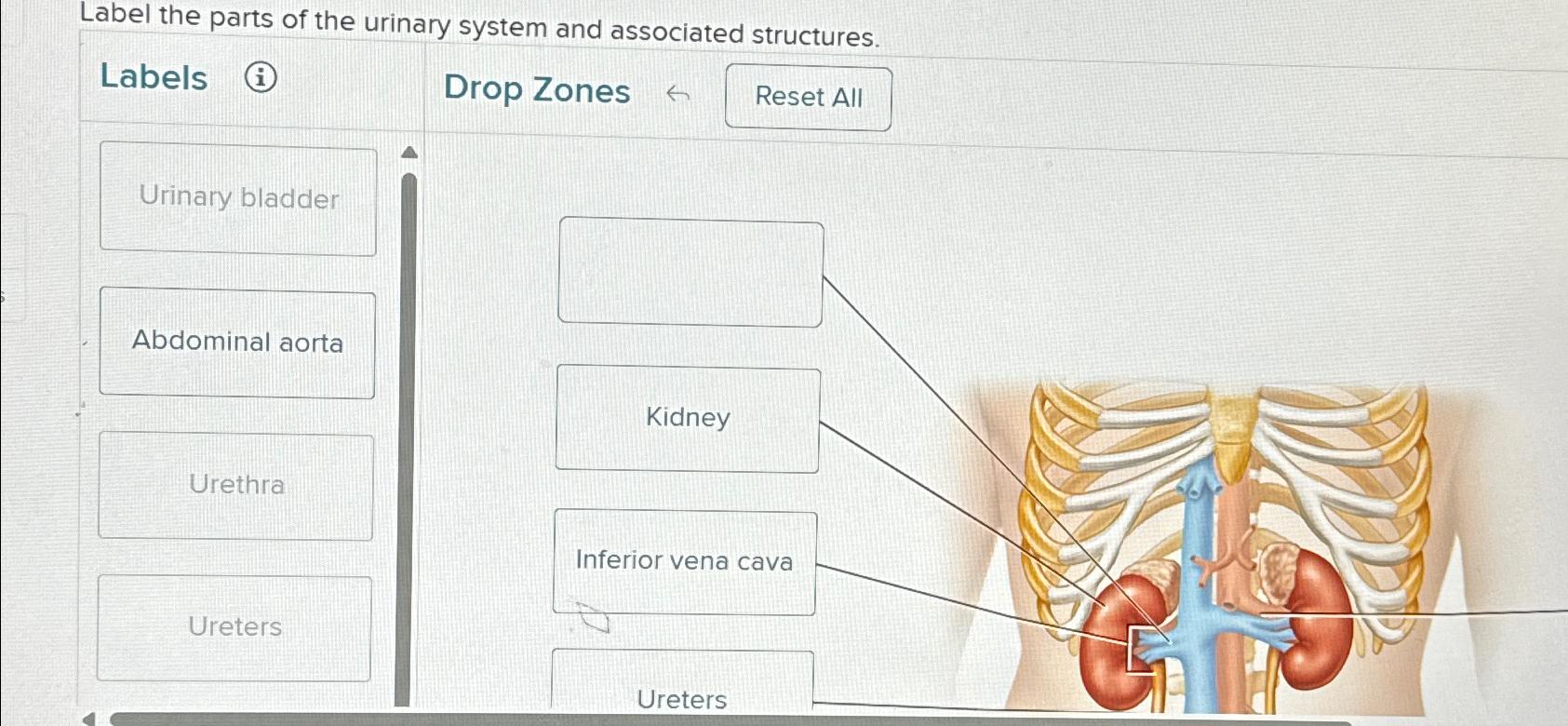 Solved Label the parts of the urinary system and associated | Chegg.com