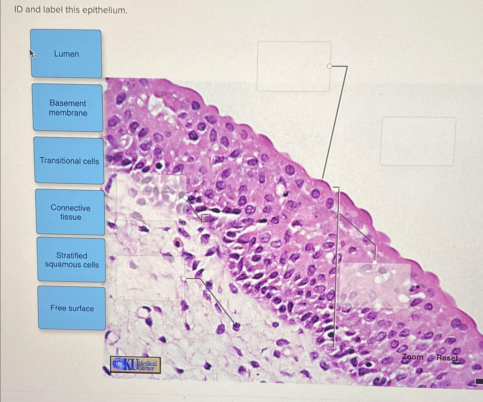 Solved ID and label this epithelium.Transitional | Chegg.com