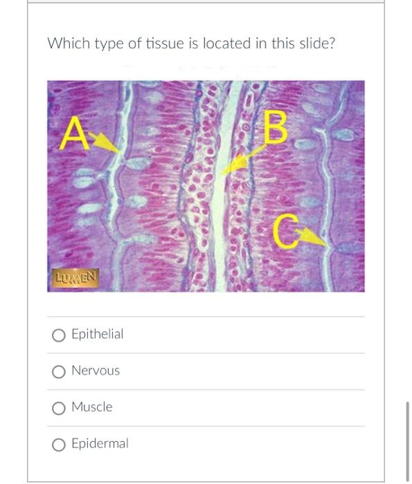 Solved What type of tissue is highlighted in blue? | Chegg.com