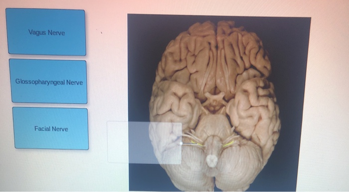 Solved Specify the name of the highlighted structures, which | Chegg.com