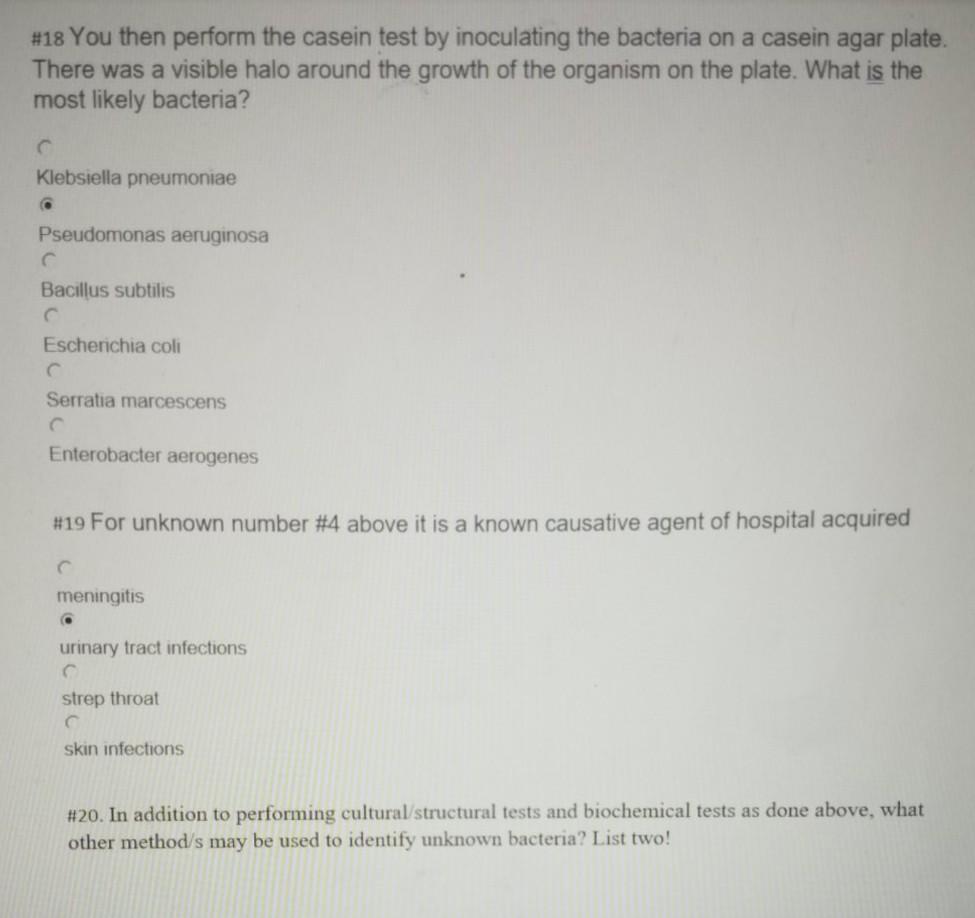 Solved #18 You then perform the casein test by inoculating | Chegg.com
