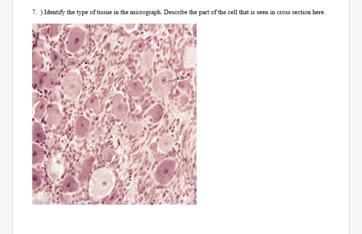 Solved 7.) Identify the type of tissue in the micrograph. | Chegg.com