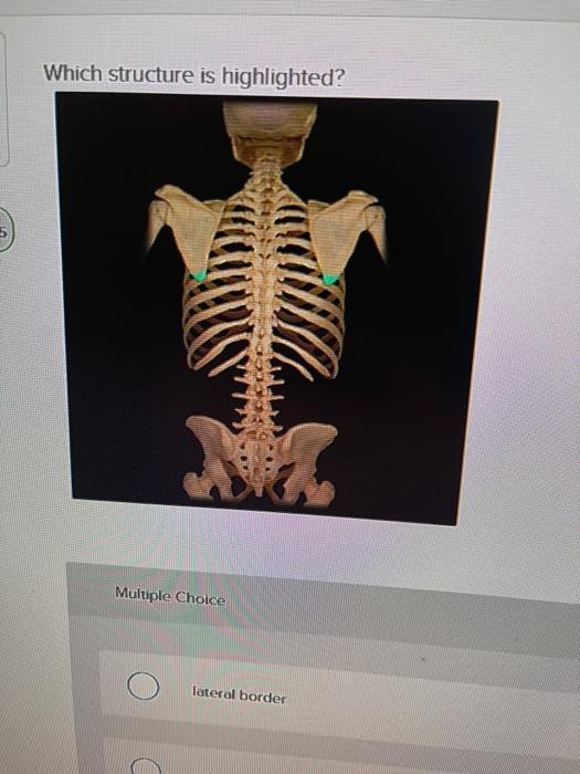 Solved Which structure is highlighted? a Multiple Choice | Chegg.com