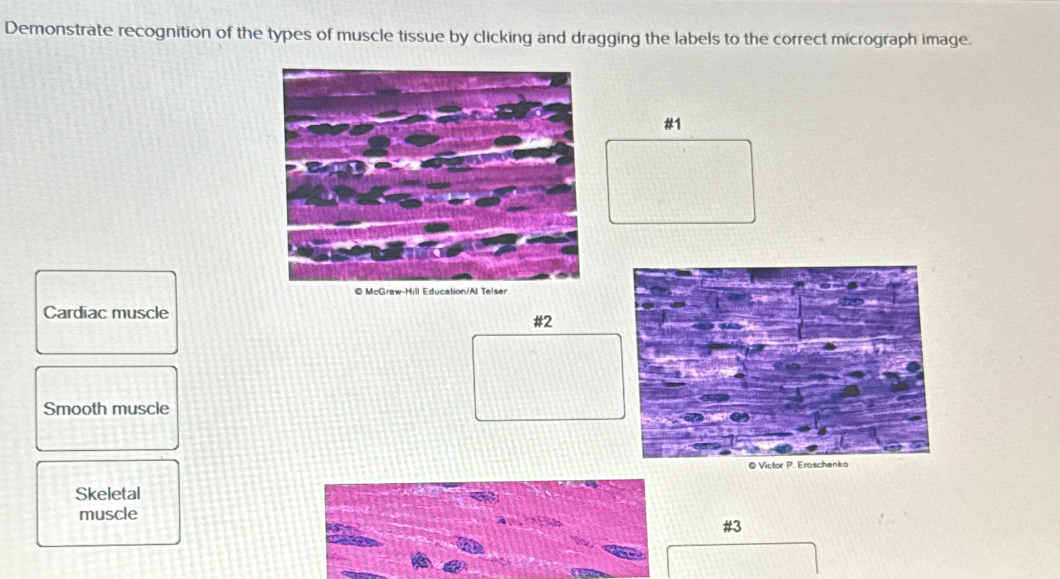 Solved Demonstrate recognition of the types of muscle tissue | Chegg.com