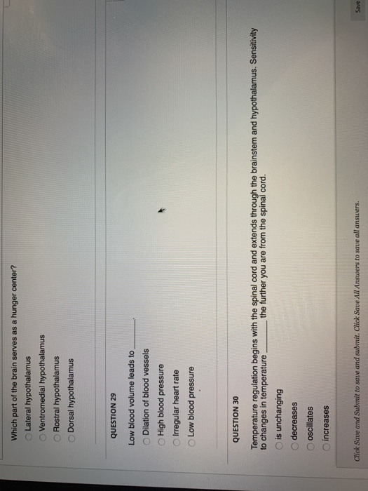 Solved Which part of the brain serves as a hunger center? | Chegg.com