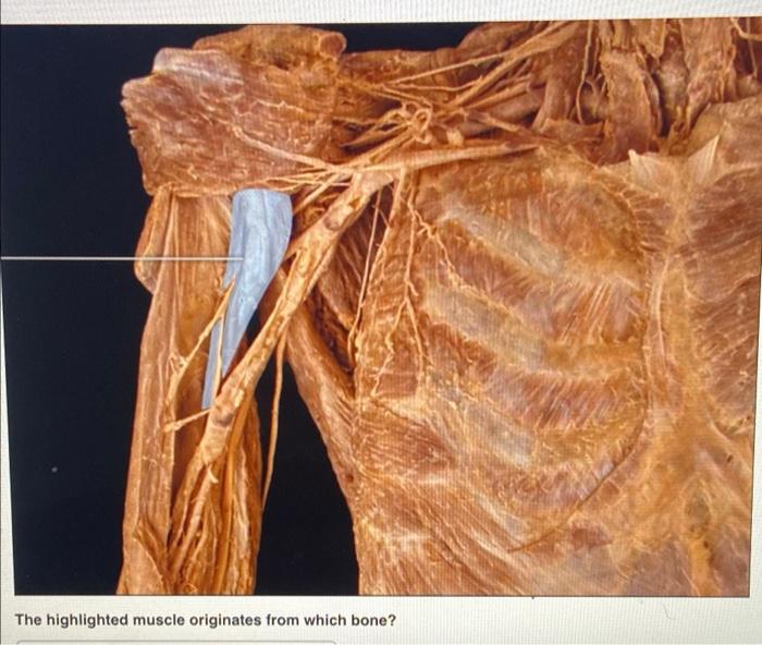 Solved The highlighted muscle originates from which bone? | Chegg.com